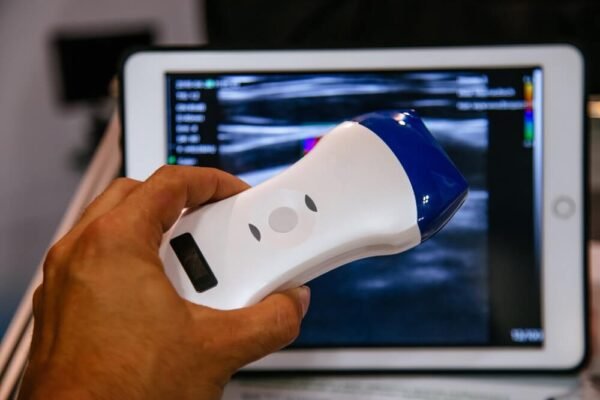 Best 15 Portable Diagnostic Ultrasound Machines for Accurate Diagnosis ...