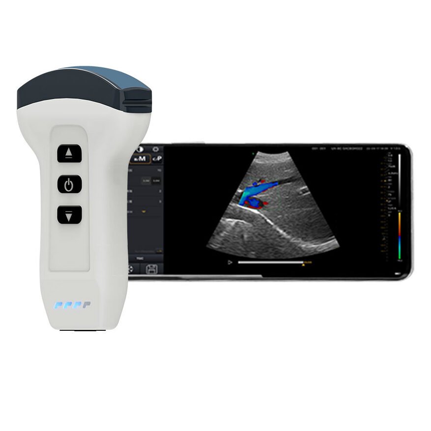 Best Portable Ultrasound Machine for Home Use - Top Picks & Features