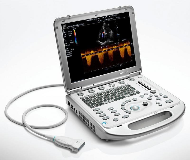 Best Portable Ultrasound Machine for Home Use - Top Picks & Features