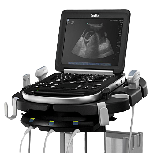 List of Cheap Portable Ultrasound Machines - Top Picks with Affordability