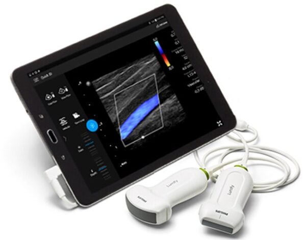 Transthoracic Echocardiogram (TTE): Procedure, Uses, & Cost - Portable ...